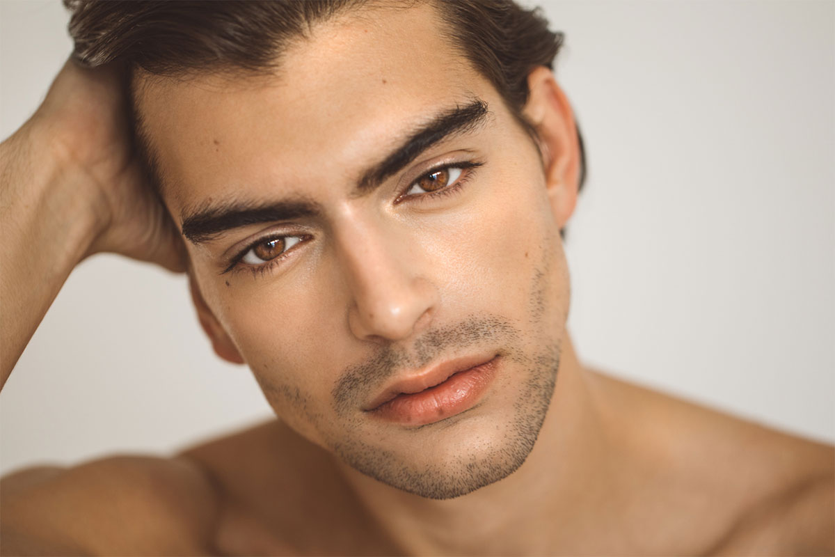 Revanesse Versa+ and Revanesse Lips+ in Sacramento, CA